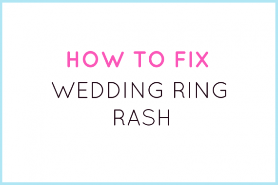How to Fix Wedding Ring Rash with Quick + Easy Tips | Emmaline Bride ...